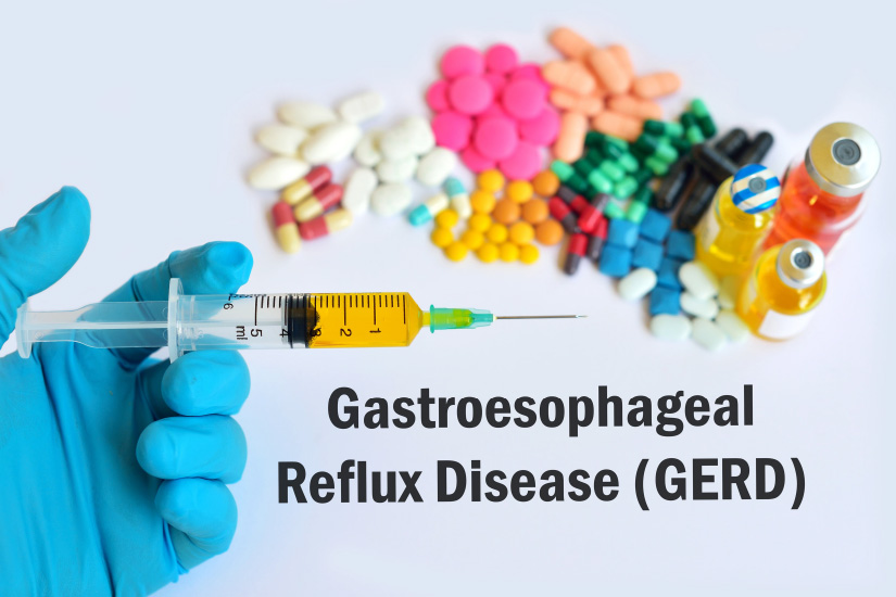 Q & A: Gastroesophageal Reflux Disease (GERD) - Prime Magazine