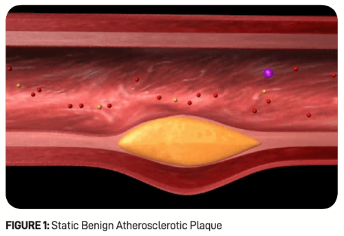 AngelMed Guardian Singapore: Heart Attack Alerts - Prime Magazine