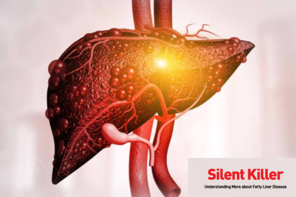 Silent Killer: Understanding More about Fatty Liver Disease - Prime ...