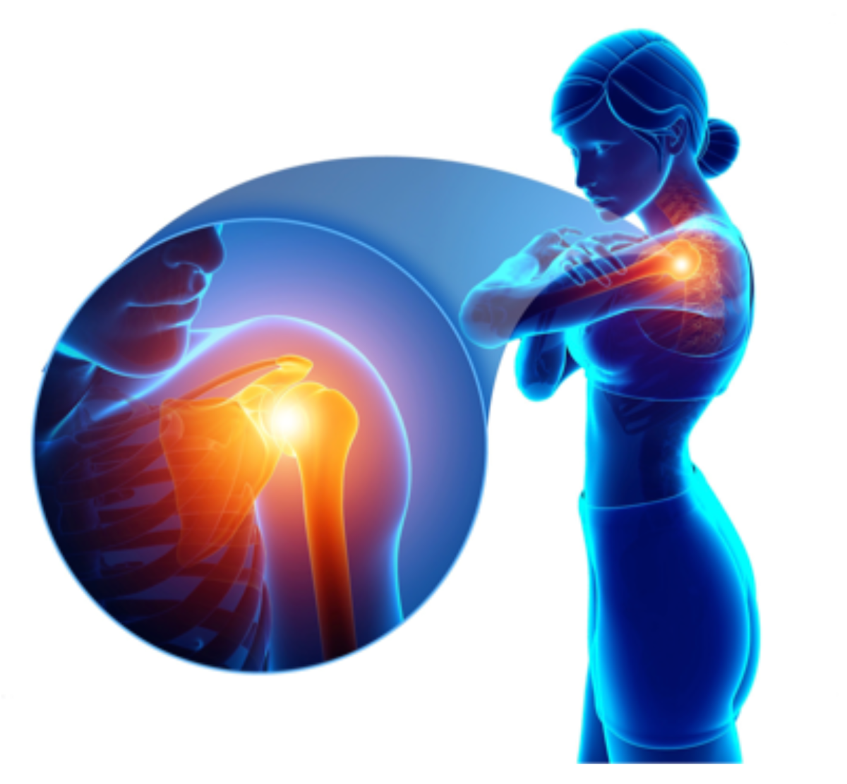 Shoulder Pain Relief: Comprehensive Management Guide - Prime Magazine